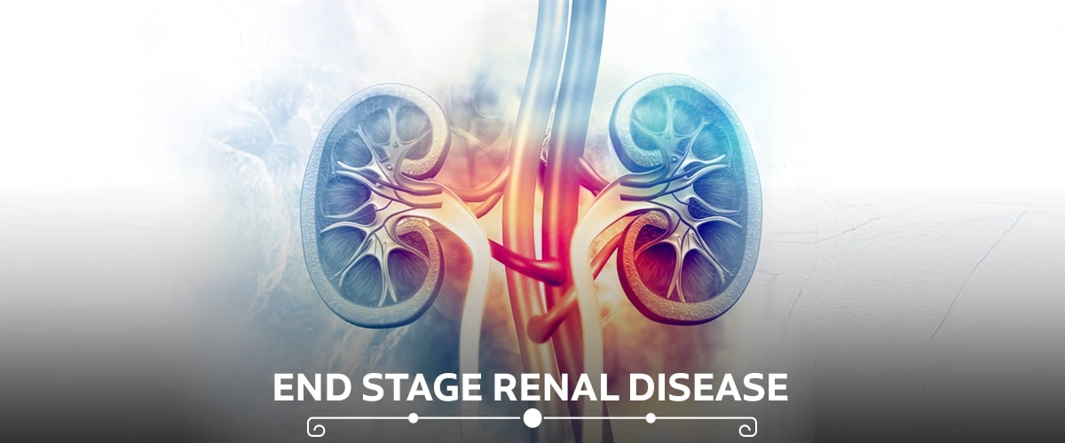 Kidney Failure Treatment in Rewari | SS Kidney & Urology Hospital